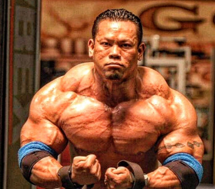 What Happened To Kris Dim? Accident and Spinal Injury Update