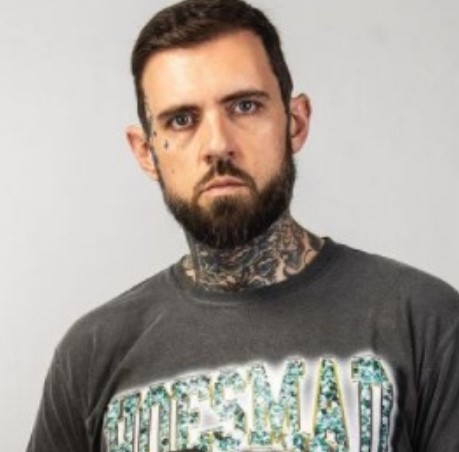 Is Adam22 Bald? Discovering the Facts About His Hair Transplant