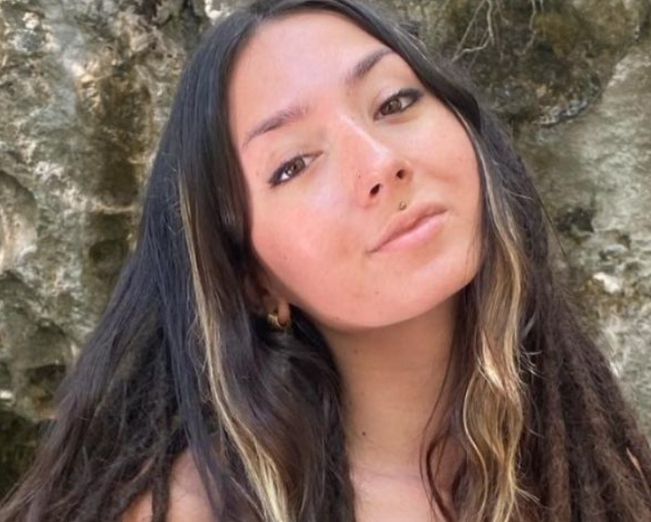 What Was the Issue with Shani Louk Teeth? Did She Use Braces or Whitening?